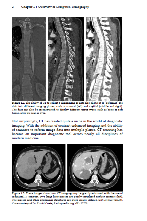 CT Physics & Imaging: A Guide for Technologists | CT Physics & Imaging