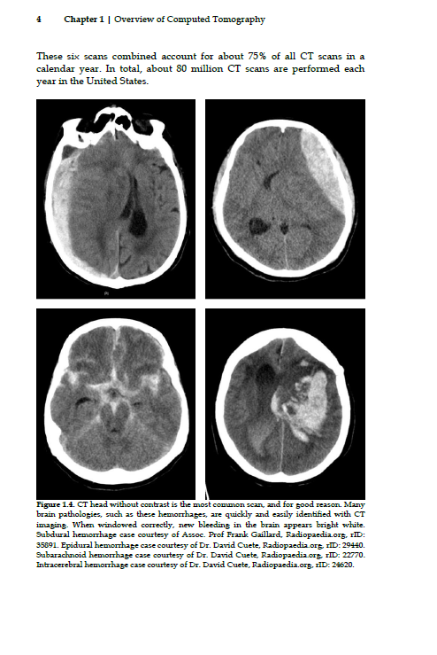 CT Physics & Imaging | eBook | CT Physics & Imaging